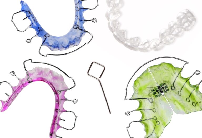 4 Tips for Caring for Your Retainer | One Dental New Jersey Blog